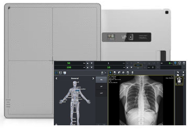 Flat Panel Para RX Wire Less Modelo VIVIX-S – Pro Life